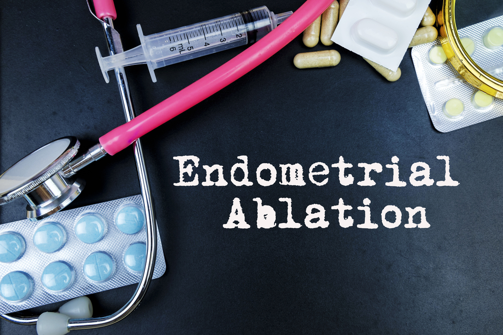 Endometrial Ablation – Procedure, Recovery, Risks, And More